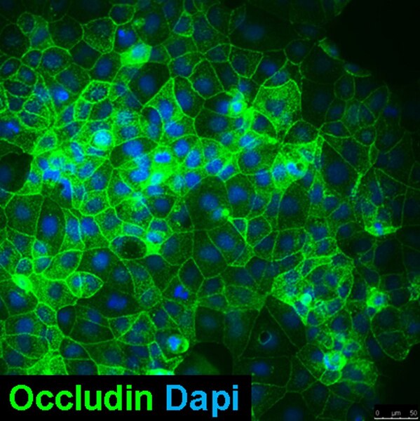 Caco-2/TC-7 Human Colon Adenocarcinoma Cell Line | SCC209